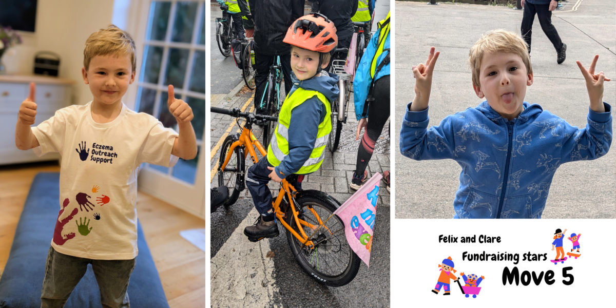 Felix gets on his bike for Move 5 2024 – Eczema Outreach Support